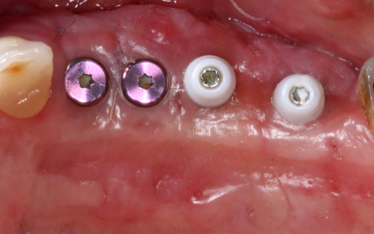 soft_tissue_clinical_3 - 2025 Soft Tissue Master Session in Los Angeles ...